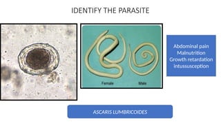 INTESTINAL NEMATODES practical microbiology | PPTX