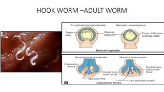 INTESTINAL NEMATODES practical microbiology | PPTX