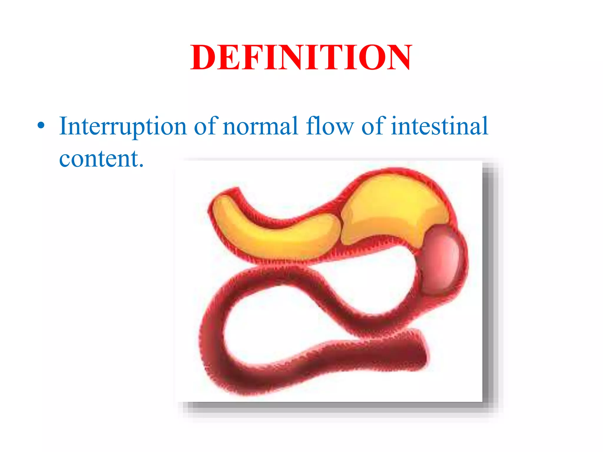 Intestinal Obstruction | PPTX