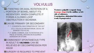 Intestinal obstruction | PPT