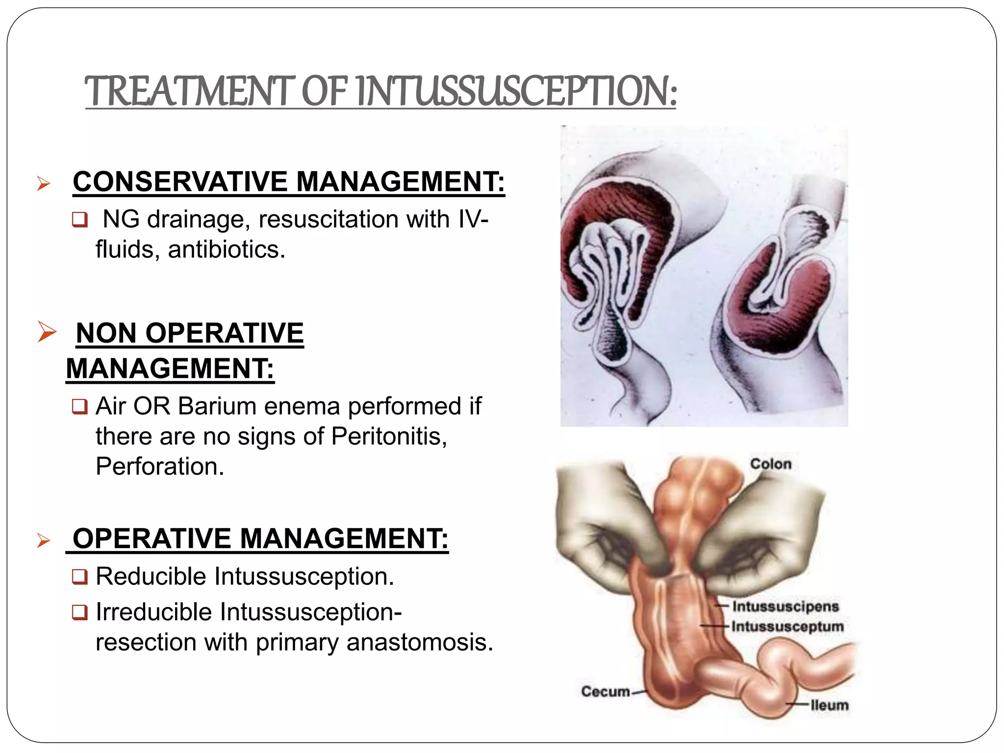 Surgical Management of Intestinal Obstruction | PPTX