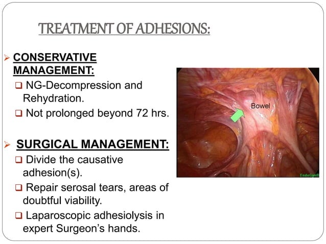Surgical Management of Intestinal Obstruction | PPT