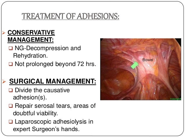Surgical Management of Intestinal Obstruction