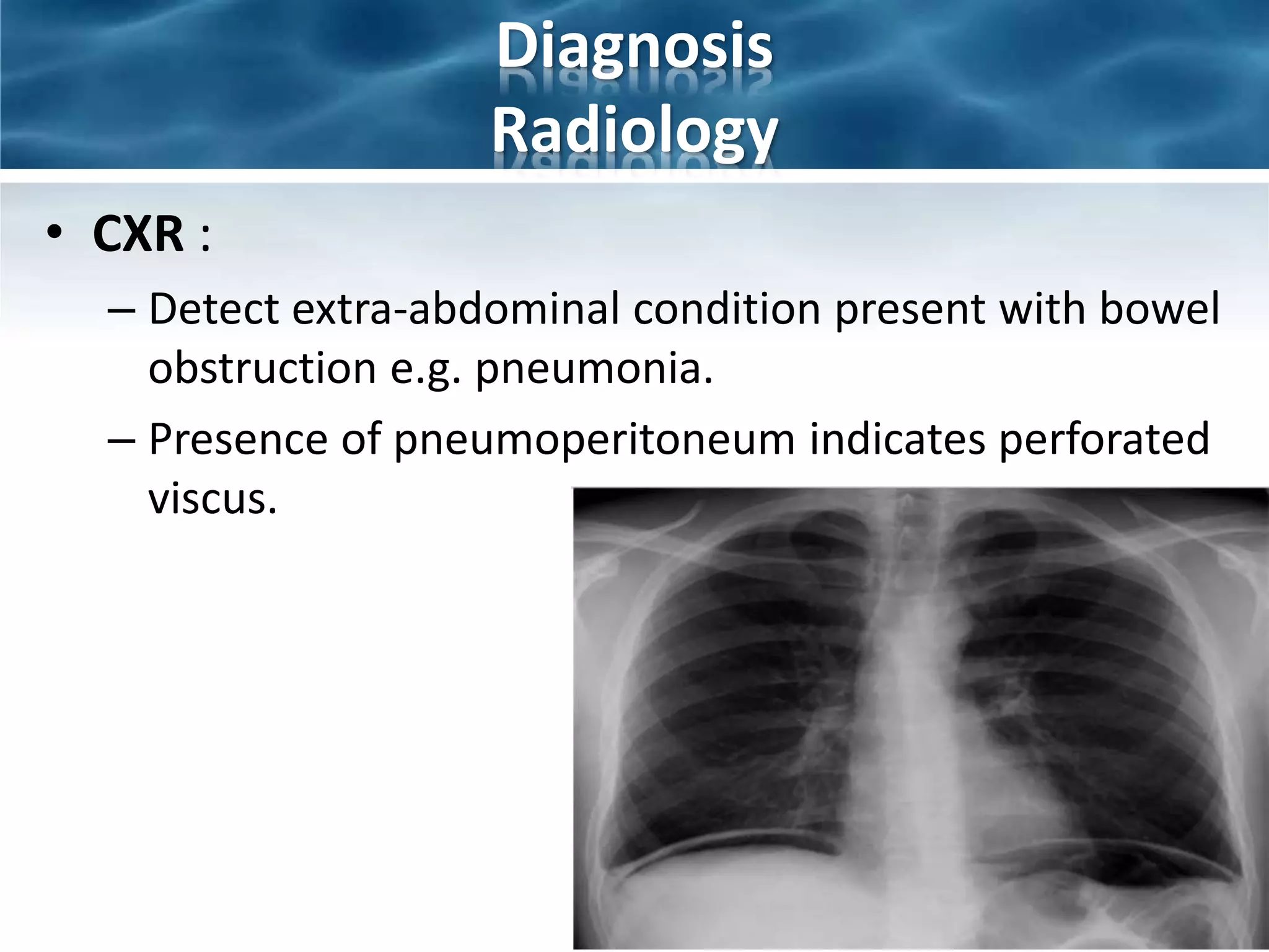 Intestinal obstruction | PPTX
