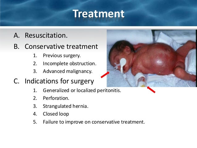 Intestinal obstruction