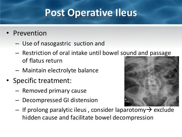 Intestinal obstruction