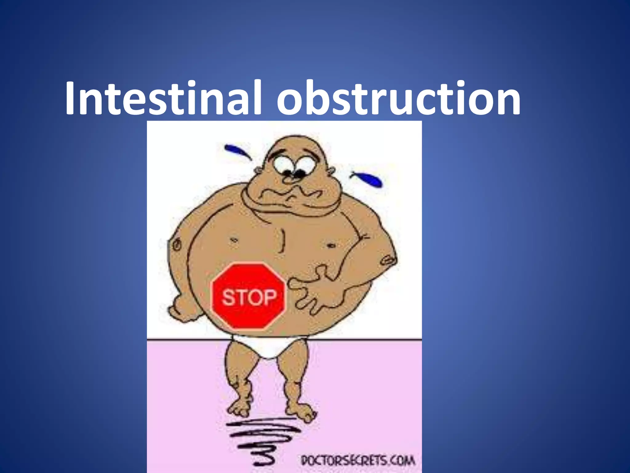 Intestinal obstruction | PPTX | Digestive Disorders | Diseases and ...
