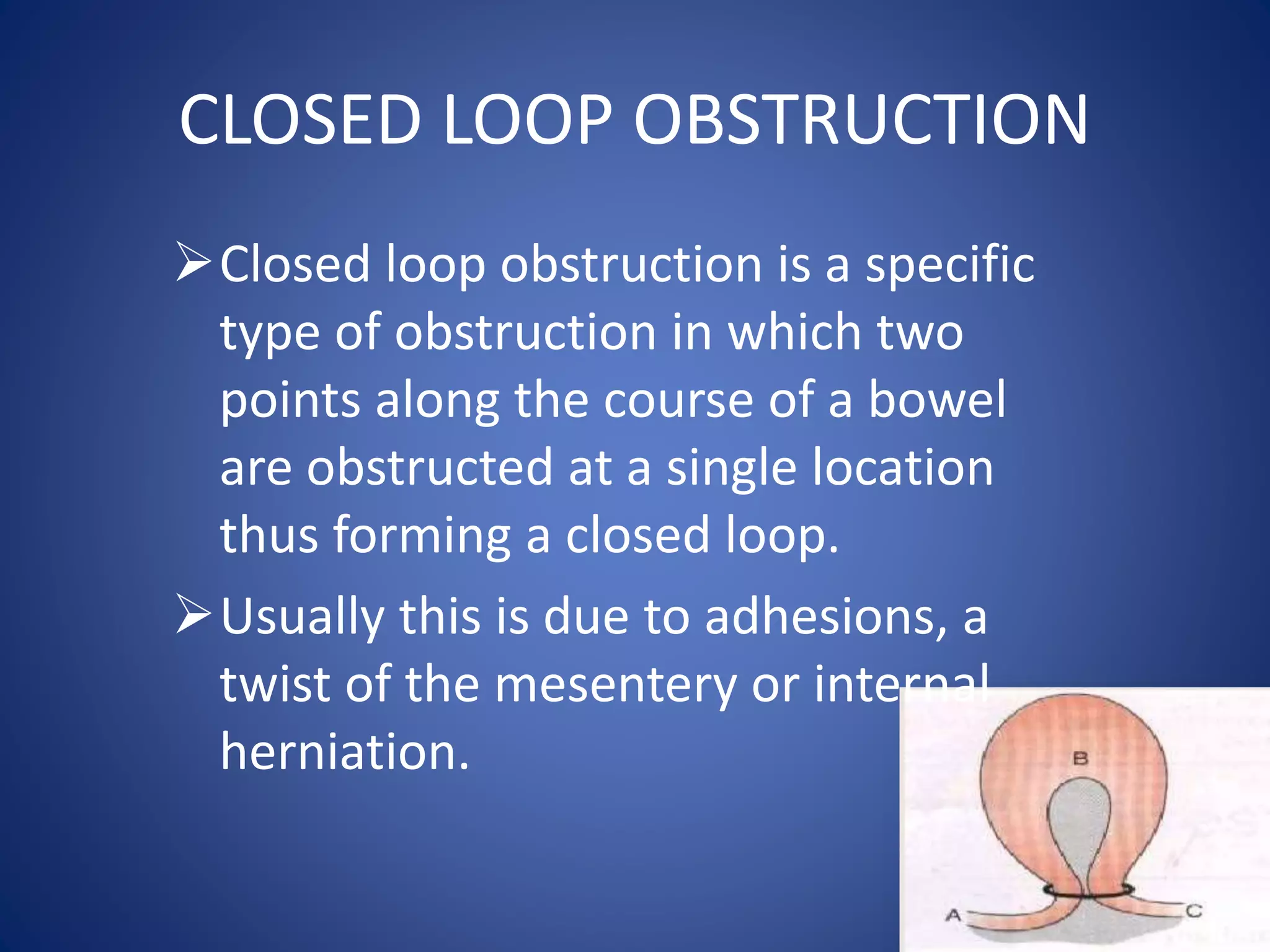 Intestinal obstruction | PPTX | Digestive Disorders | Diseases and ...