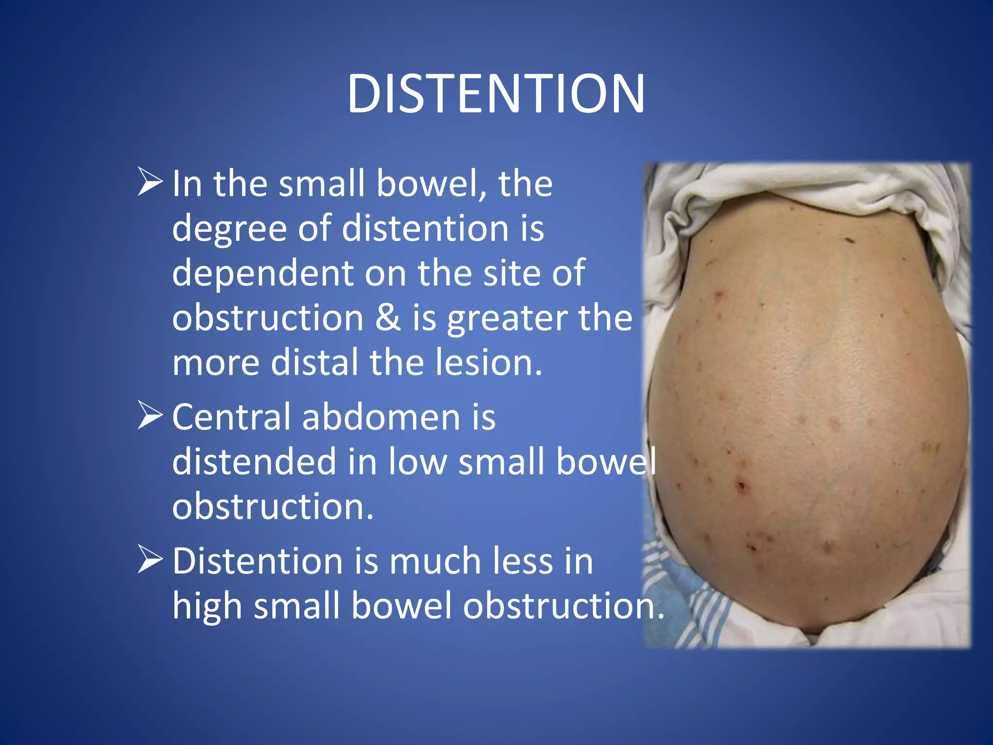 Intestinal obstruction | PPTX