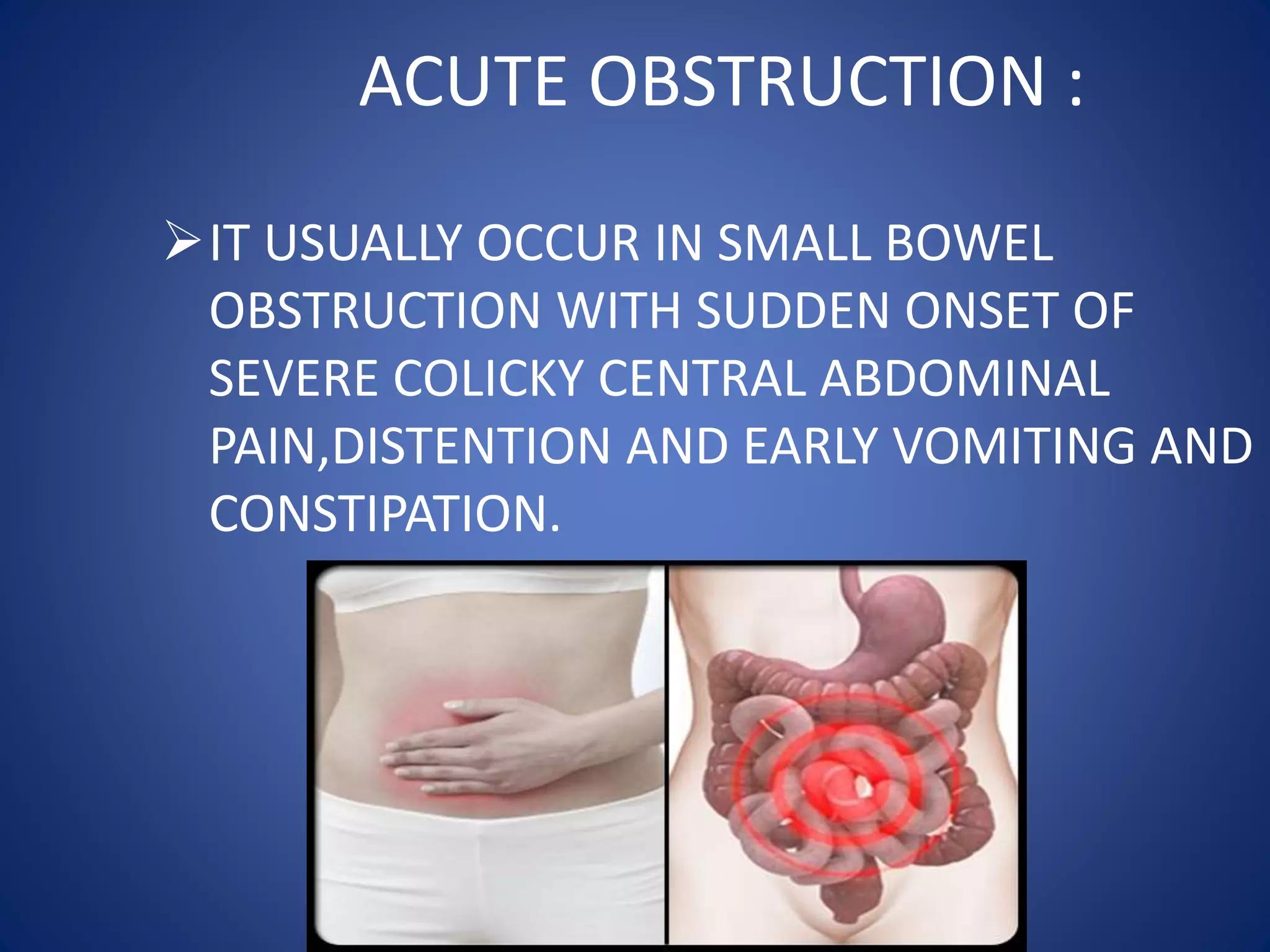 Intestinal obstruction | PPTX | Digestive Disorders | Diseases and ...