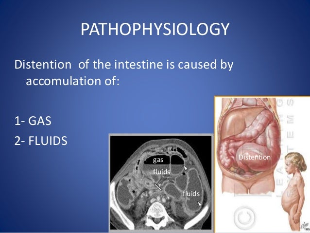 Intestinal obstruction
