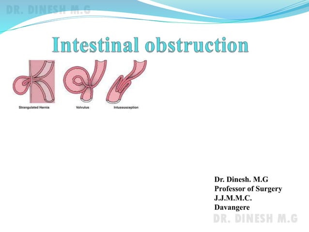 Intestinal Obstruction | PPTX