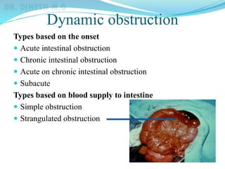 Intestinal Obstruction | PPTX