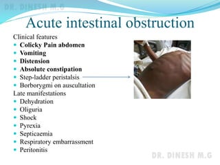 Intestinal Obstruction | PPTX