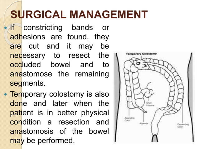 Intestinal obstruction with Nursing Management | PPTX