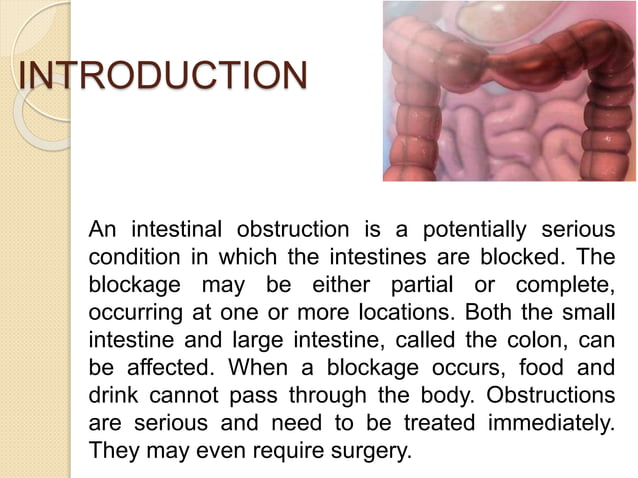 Intestinal obstruction with Nursing Management | PPTX