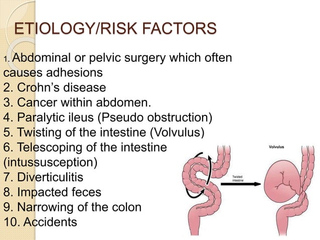 Intestinal obstruction with Nursing Management