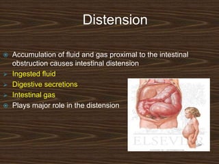 Intestinal obstruction | PPTX