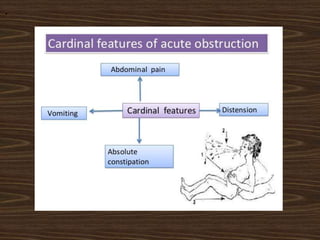 Intestinal obstruction | PPTX