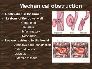 Intestinal obstruction | PPTX