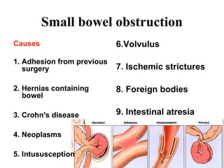 Intestinal obstruction | PPT