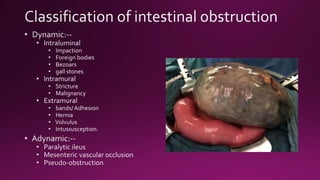 Intestinal obstruction | PPT
