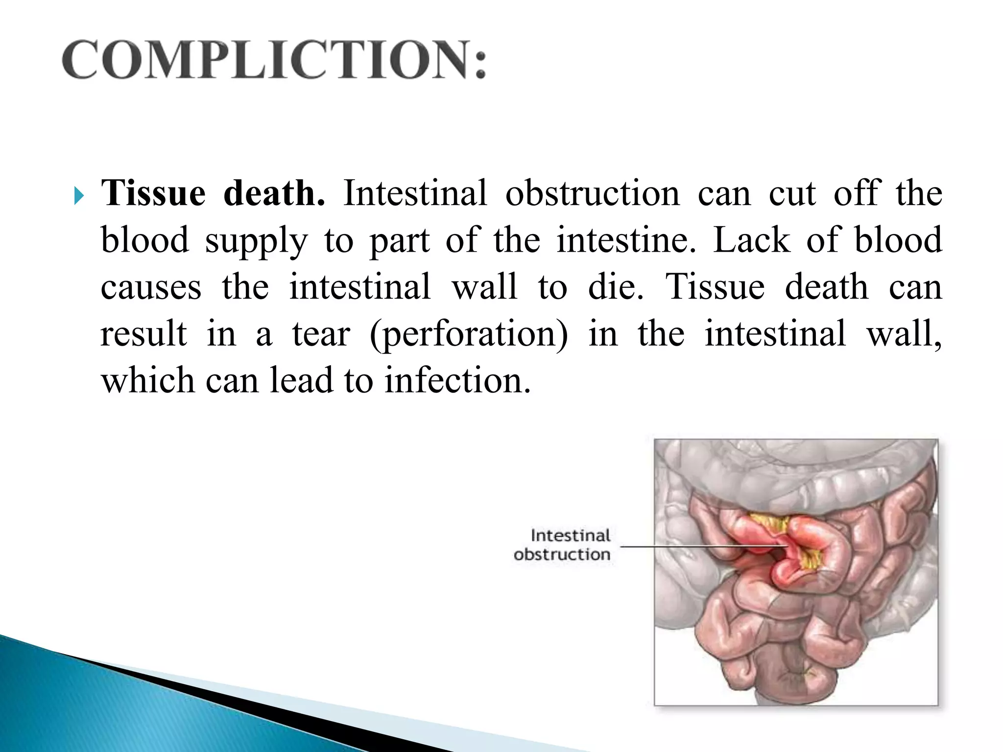 Intestinal obstruction | PPTX