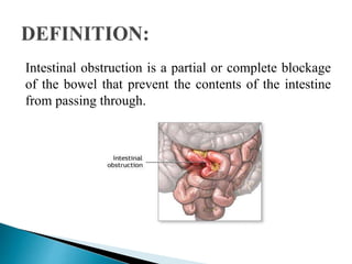 Intestinal obstruction | PPT