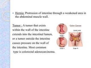 Intestinal obstruction | PPTX