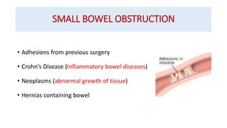 INTESTINAL OBSTRUCTION | PPT