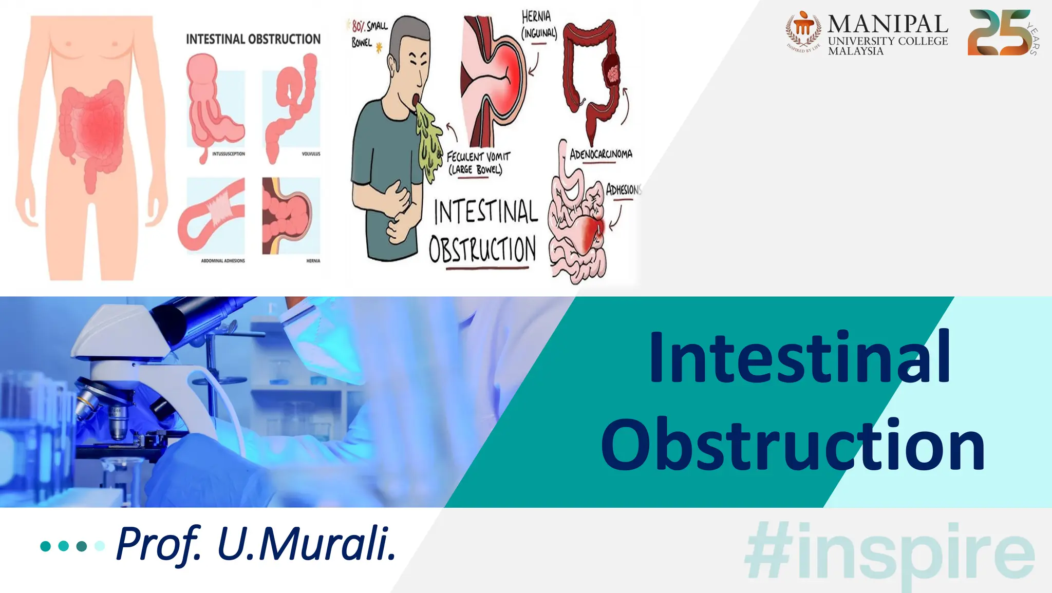 Intestinal Obstruction - Types, C/F & Management | PDF