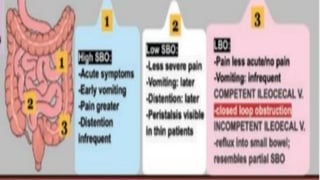 Intestinal Obstruction - Types, C/F & Management | PDF