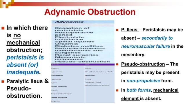 Intestinal Obstruction - Types, C/F & Management | PPT