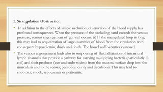 A Slide on INTESTINAL or bowel OBSTRUCTION.pptx