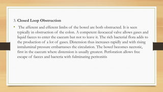 A Slide on INTESTINAL or bowel OBSTRUCTION.pptx