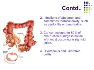 INTESTINAL OBSTRUCTION and its management .ppt