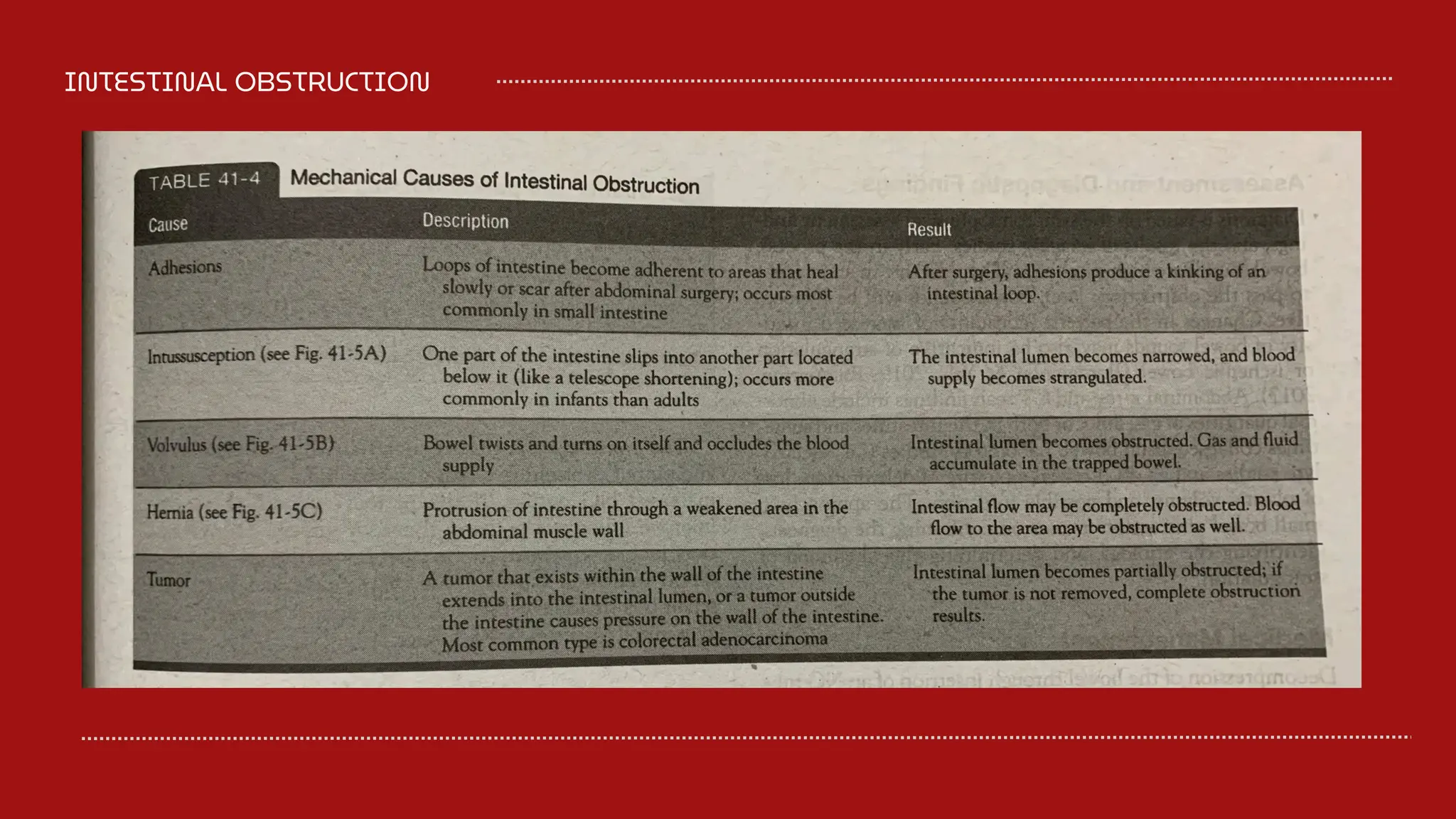 INTESTINAL OBSTRUCTION.pdf. health companion | PDF