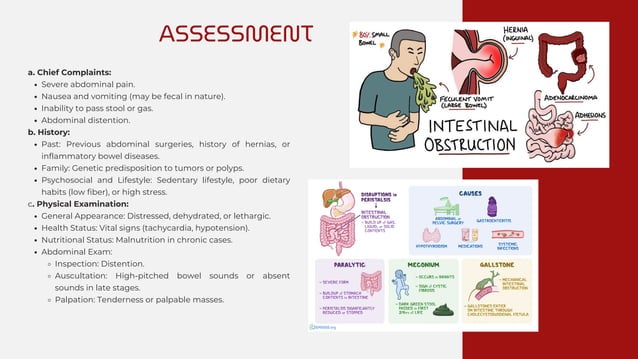 INTESTINAL OBSTRUCTION.pdf. health companion | PPT