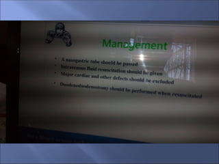 intestinal obstruction notes surgical department | PPT