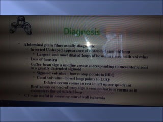 intestinal obstruction notes surgical department | PPT