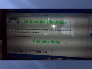intestinal obstruction notes surgical department | PPT