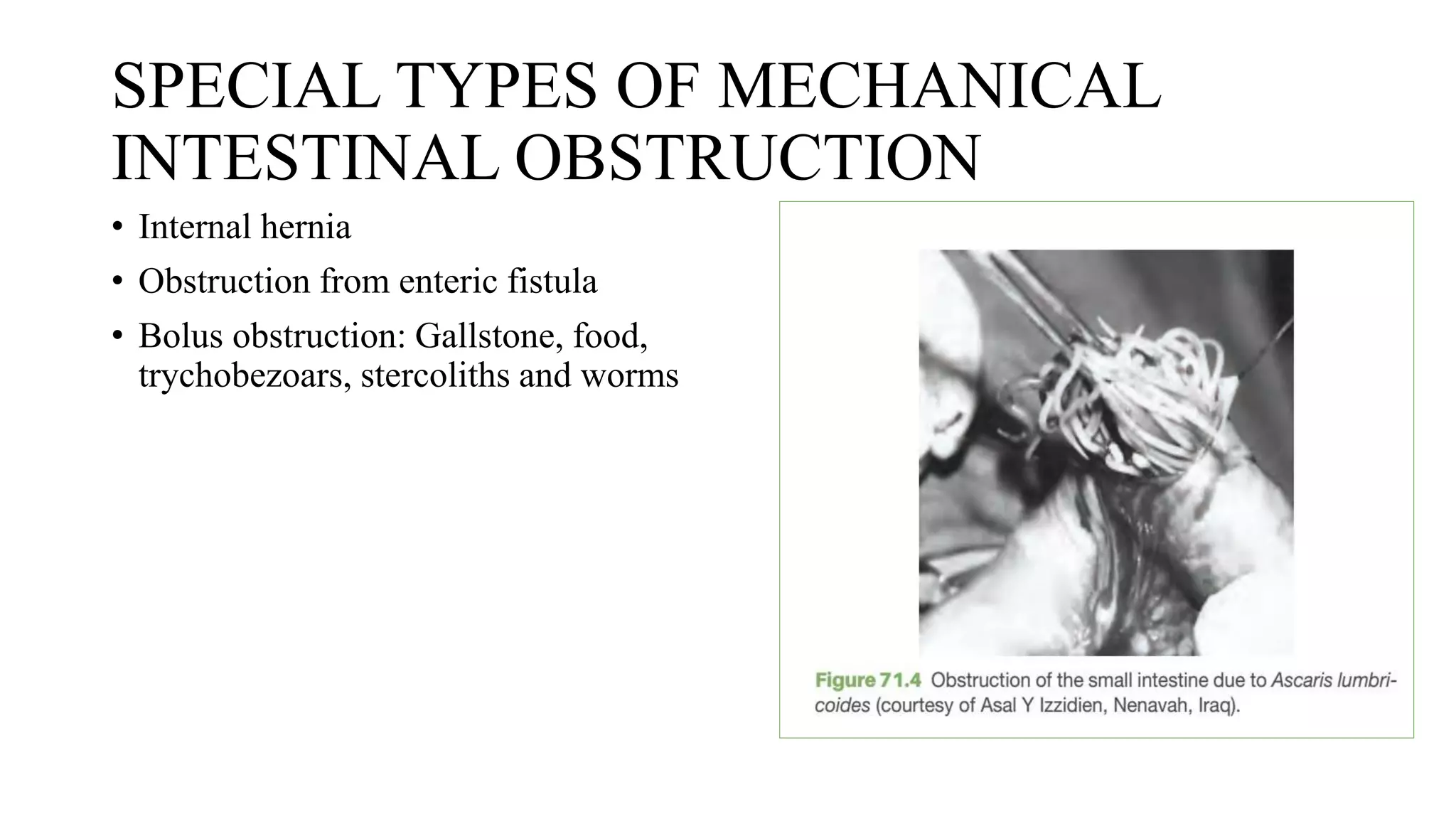 Intestinal Obstruction | PPTX