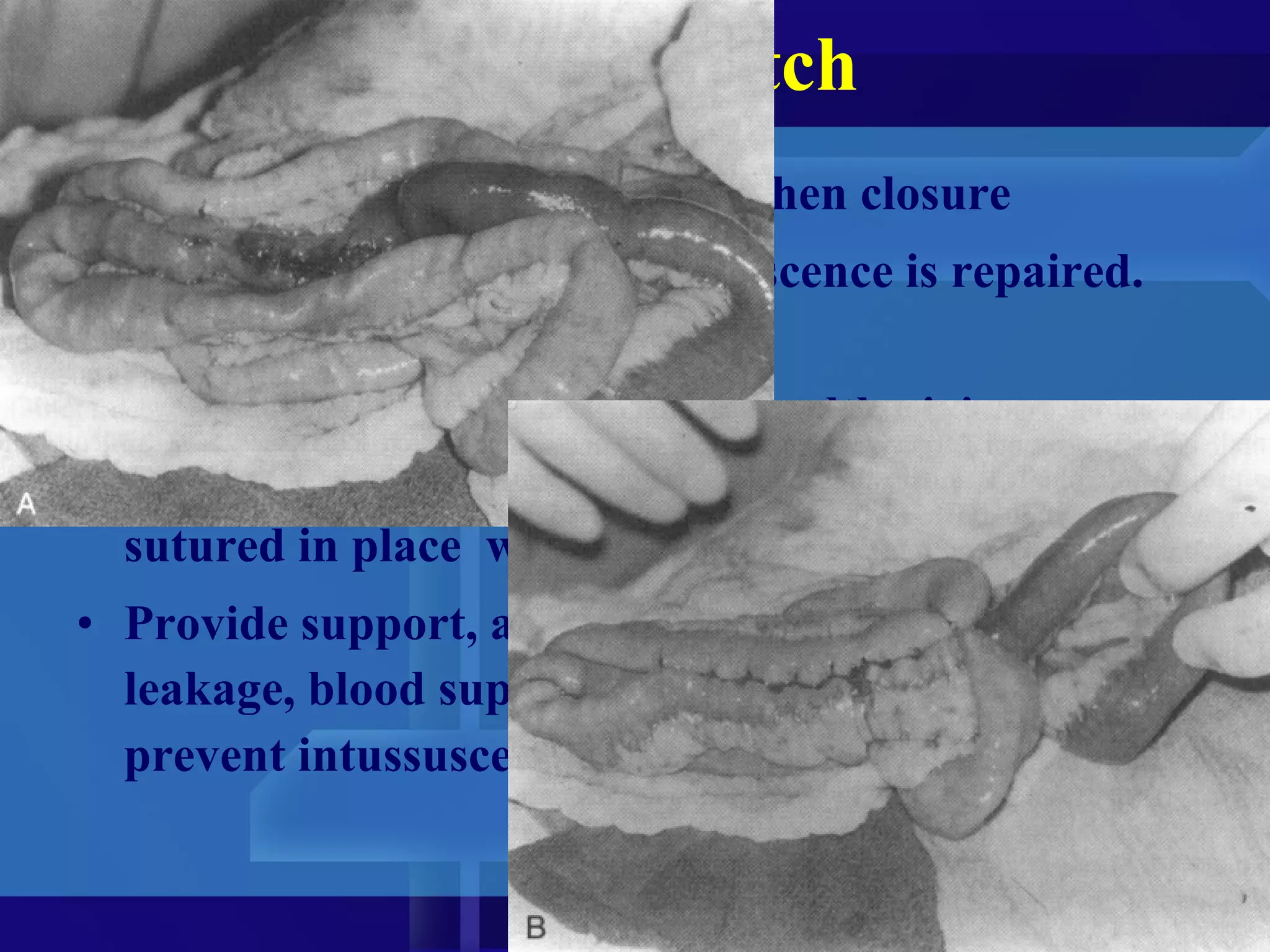 Intestinal obstruction in small animals | PPT