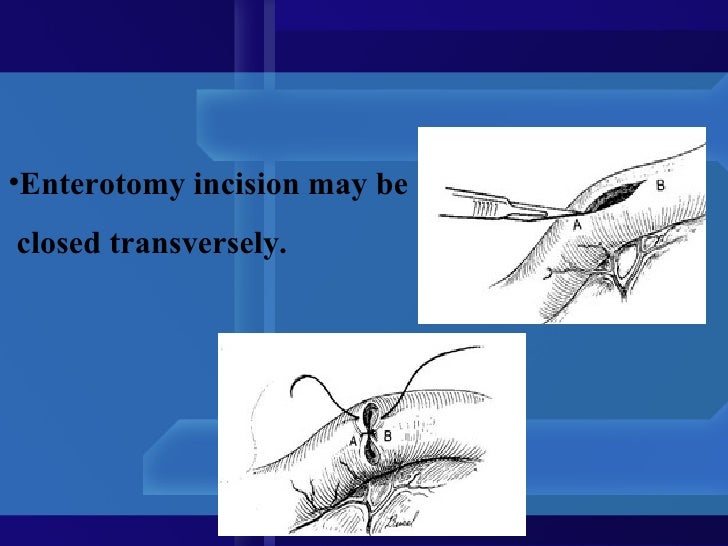 Intestinal obstruction in small animals