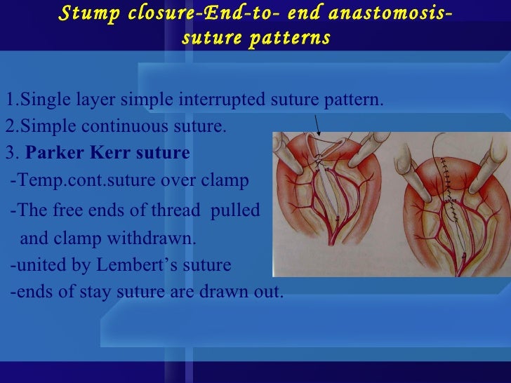 Intestinal obstruction in small animals