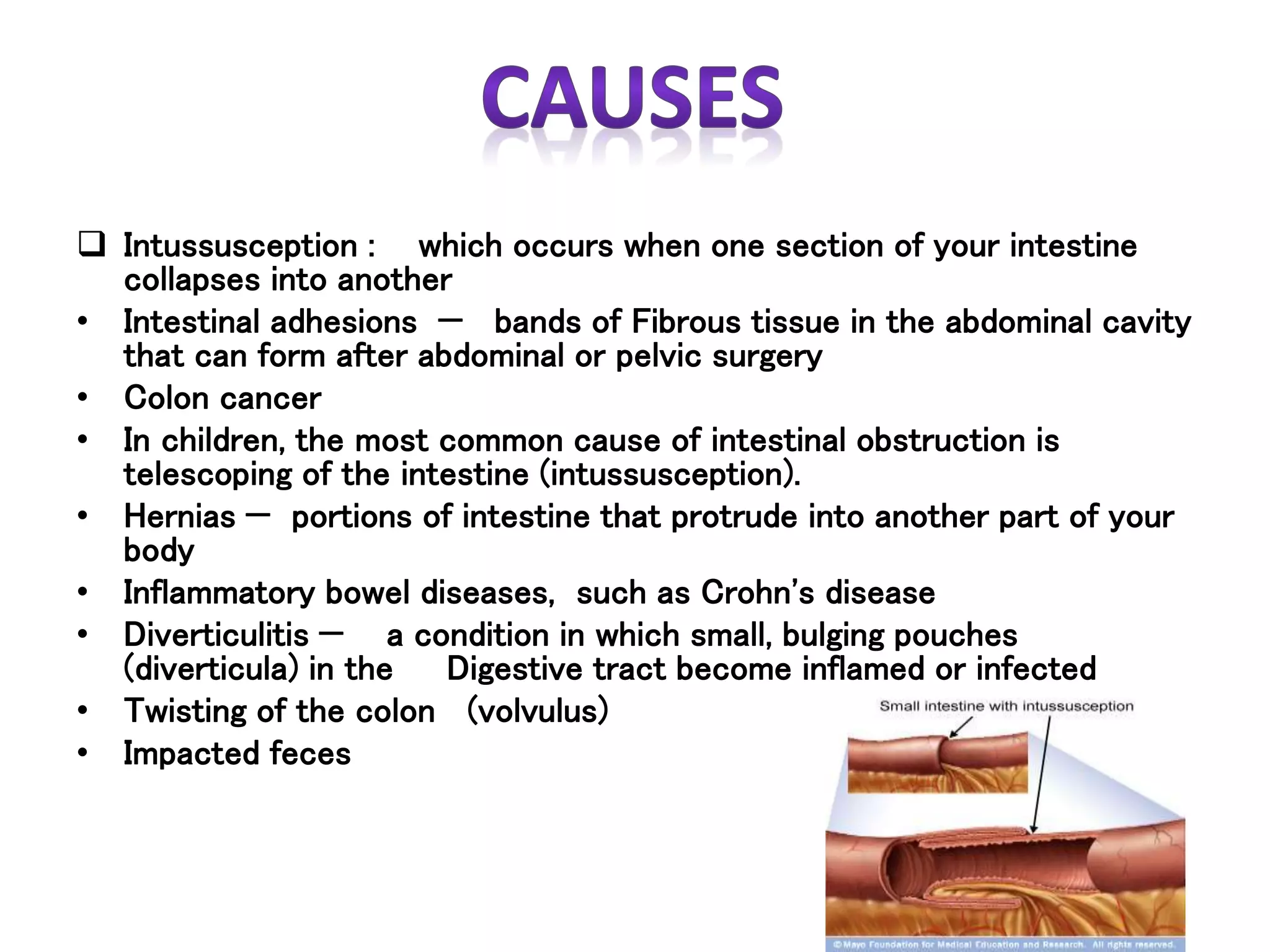 INTESTINAL_OBSTRUCTION_PPT.pptx