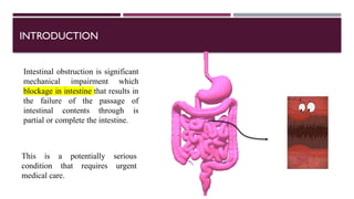 INTESTINAL OBSTRUCTION ppt [Autosaved].pptx