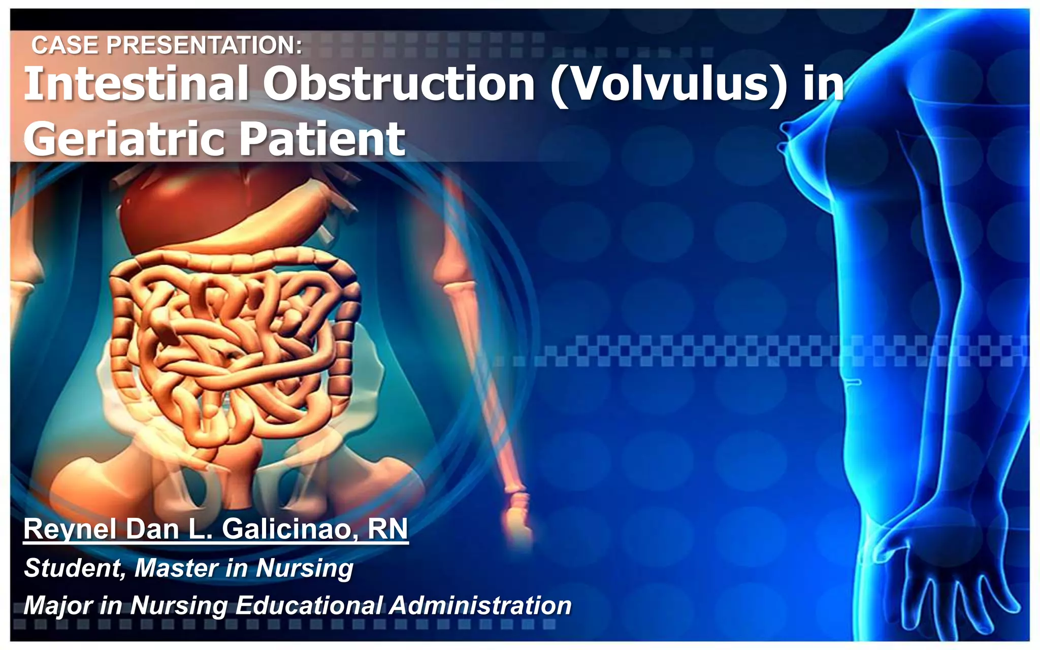 Intestinal obstruction (volvulus) in geriatric patient | PPTX