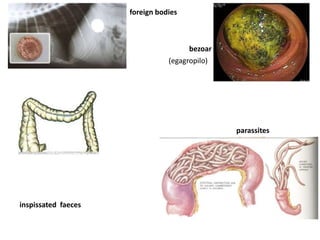 INTESTINAL OCCLUSION.pptx