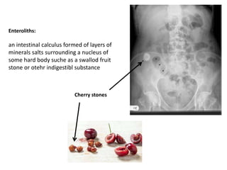 INTESTINAL OCCLUSION.pptx